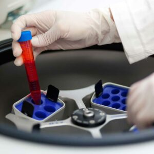 Centrifuge Calibration & Certification | Allometrics Texas ISO17025