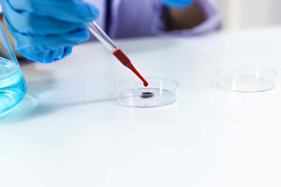 Microbial Testing Service {USP Compliant} ISO 17025 Accredited Lab