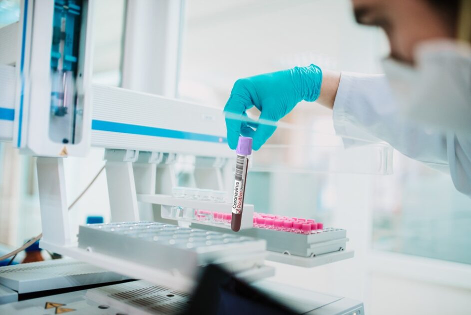 Instrument Calibration for COVID-19 Testing | Allometrics